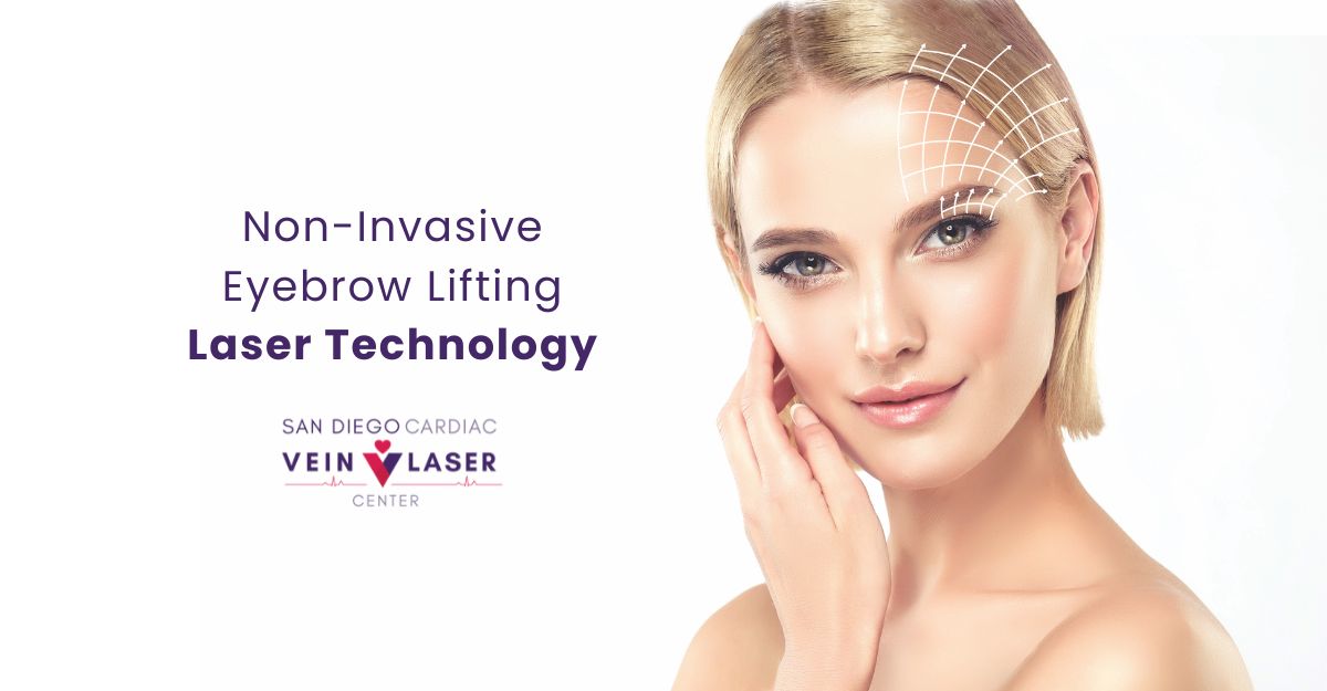 Eyebrow Lifting Laser Therapy - FRAC3®
