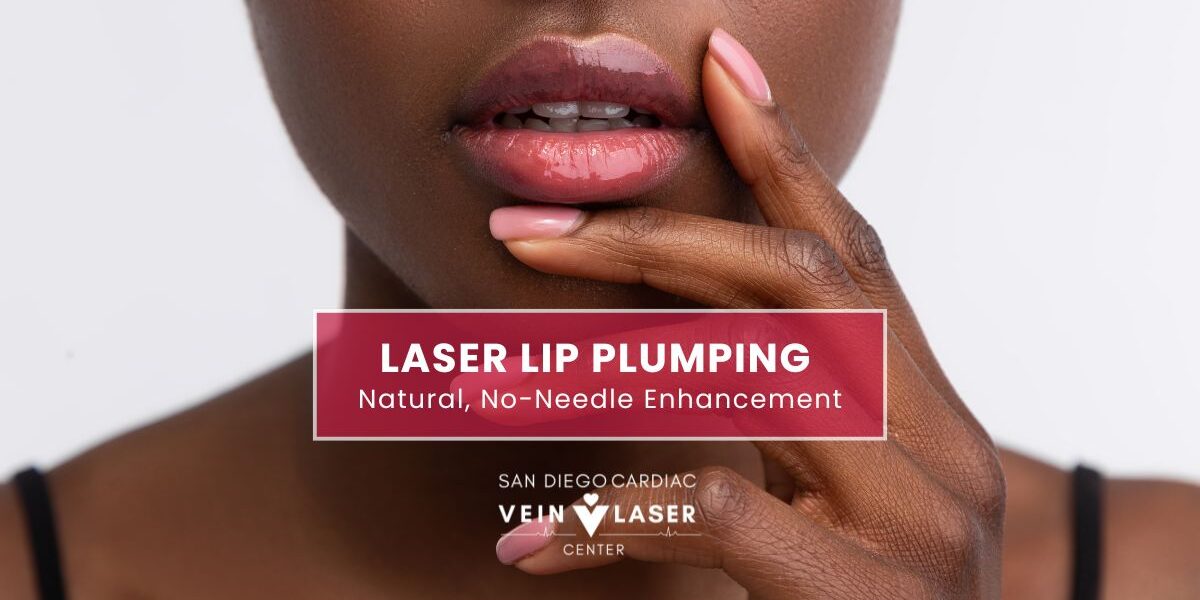 Laser Lip Plumping in San Diego - San Diego Cardiac Vein and Laser Center