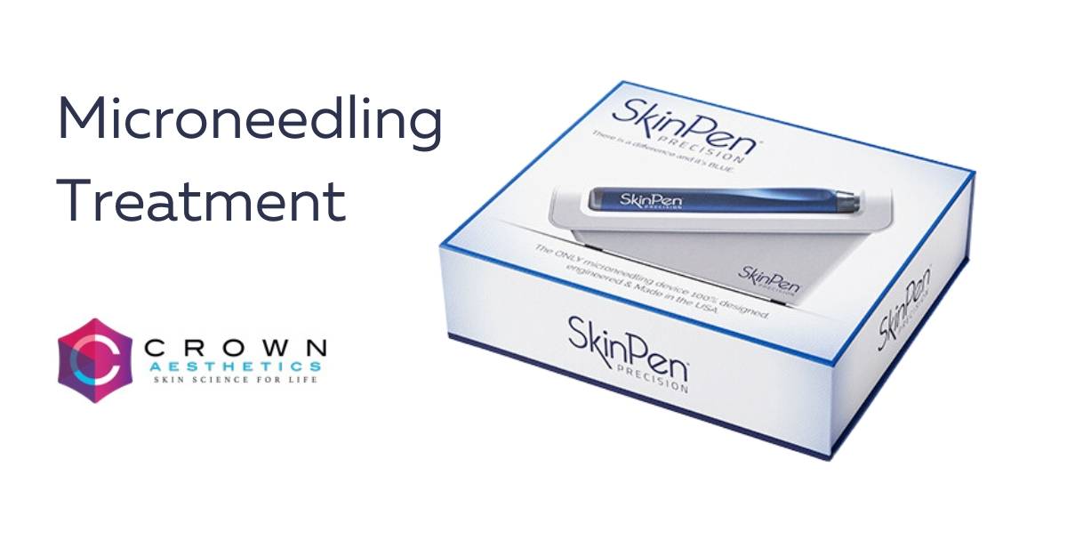 Microneedling Treatment - San Diego Cardiac Vein and Laser Center