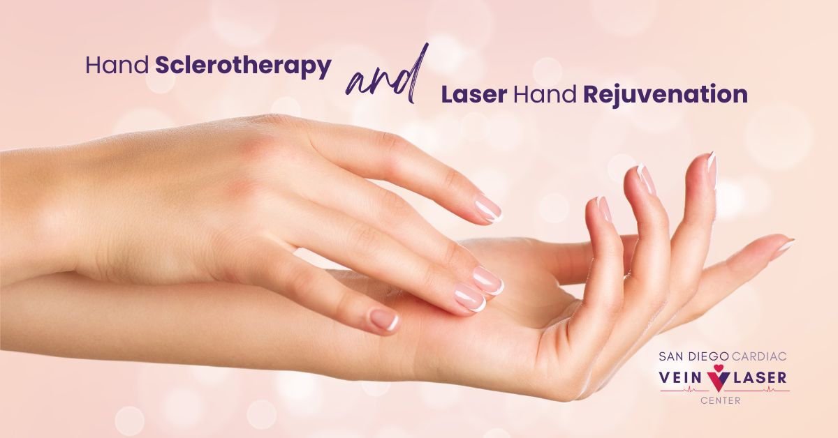 Hand Sclerotherapy and Laser Hand Rejuvenation Treatments