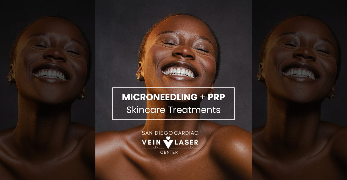 Glow On, Beautiful: Microneedling with PRP